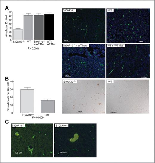 Plasminogen Receptor S100A10 Is Essential for the Migration of Tumor ...