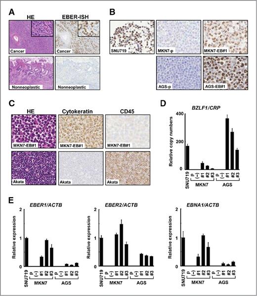 Classification of Epstein–Barr Virus–Positive Gastric Cancers by ...