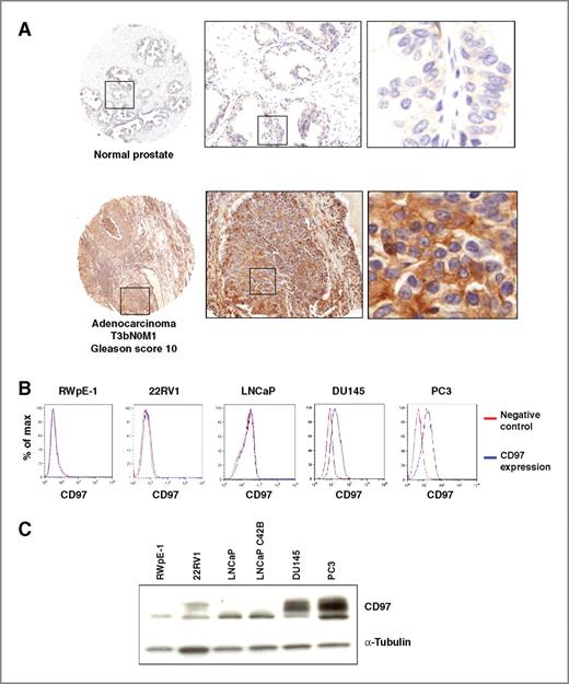 LPA Receptor Heterodimerizes with CD97 to Amplify LPA-Initiated RHO ...