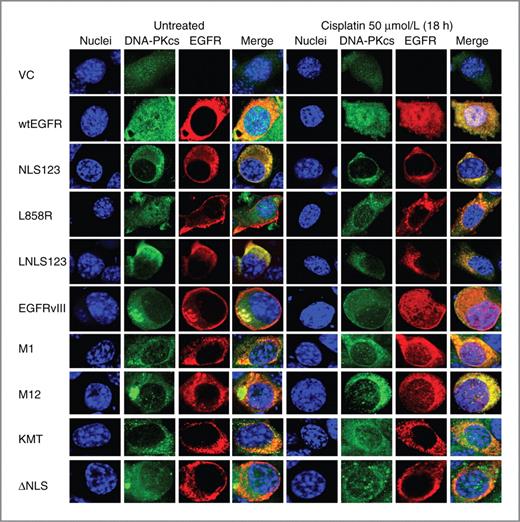 EGFR Nuclear Translocation Modulates DNA Repair following Cisplatin and ...