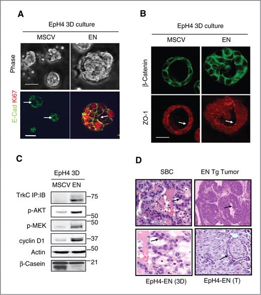 ETV6-NTRK3–Mediated Breast Epithelial Cell Transformation Is Blocked by ...