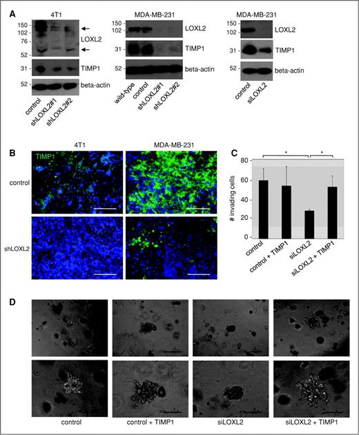 LOXL2-Mediated Matrix Remodeling in Metastasis and Mammary Gland ...