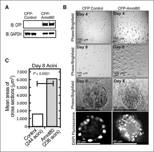 The Adaptor Protein AMOT Promotes the Proliferation of Mammary ...