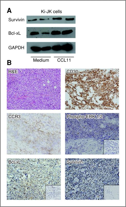 CCL11–CCR3 Interactions Promote Survival of Anaplastic Large Cell ...