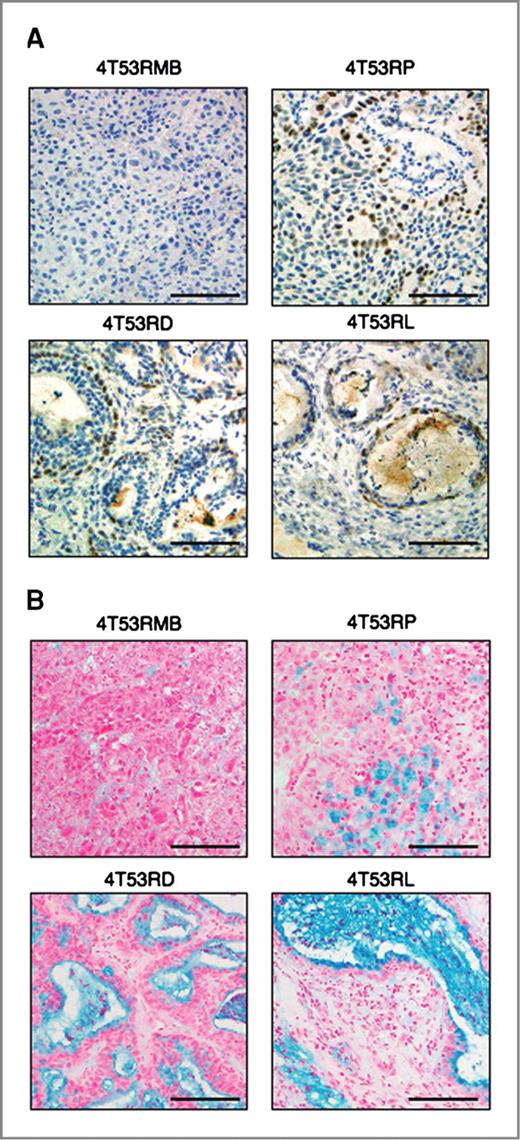 Oncogene-Mediated Human Lung Epithelial Cell Transformation Produces ...