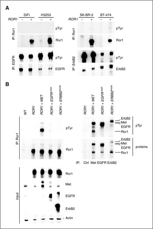 Ror1 Is a Pseudokinase That Is Crucial for Met-Driven Tumorigenesis ...