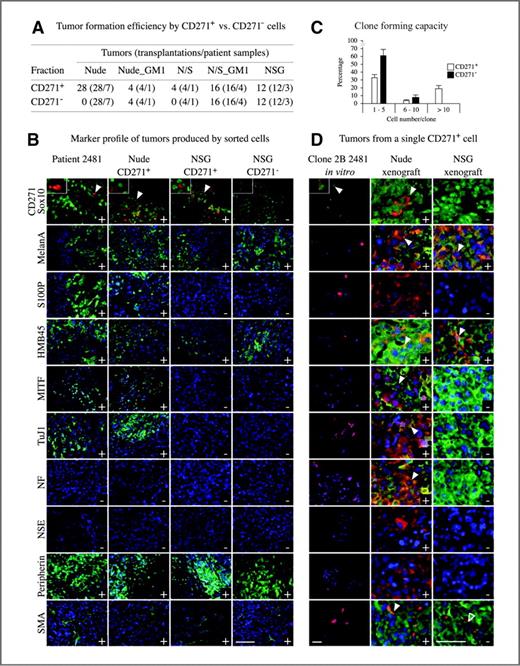Human CD271-Positive Melanoma Stem Cells Associated with Metastasis ...