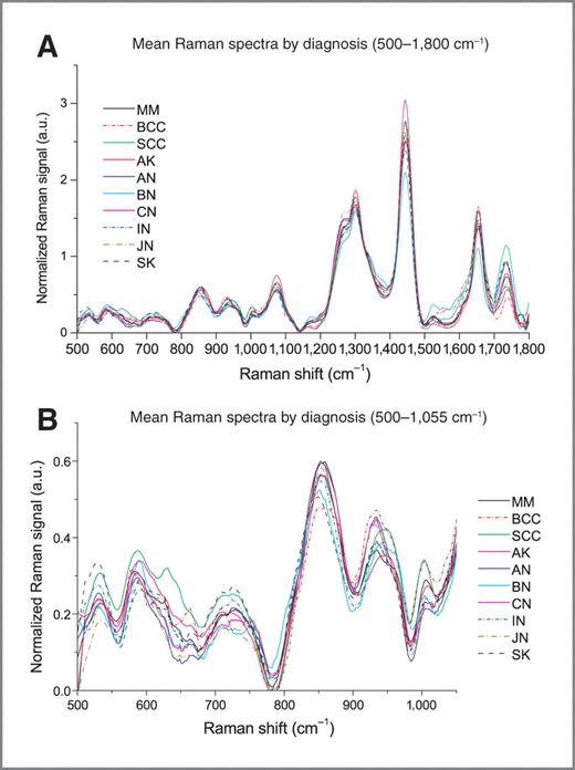 Real-time Raman Spectroscopy for In Vivo Skin Cancer Diagnosis | Cancer ...