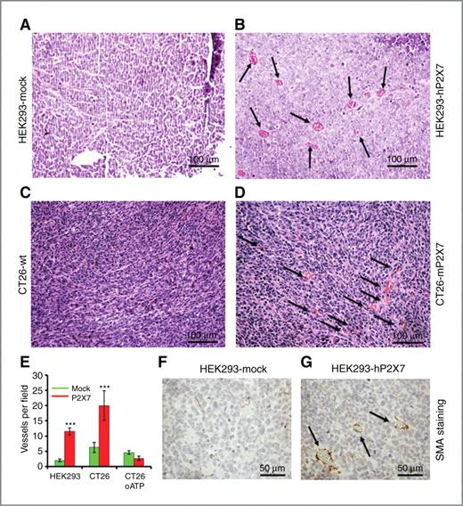 Expression of P2X7 Receptor Increases In Vivo Tumor Growth | Cancer ...
