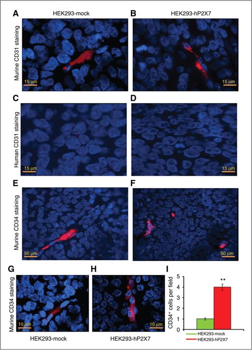 Expression of P2X7 Receptor Increases In Vivo Tumor Growth | Cancer ...