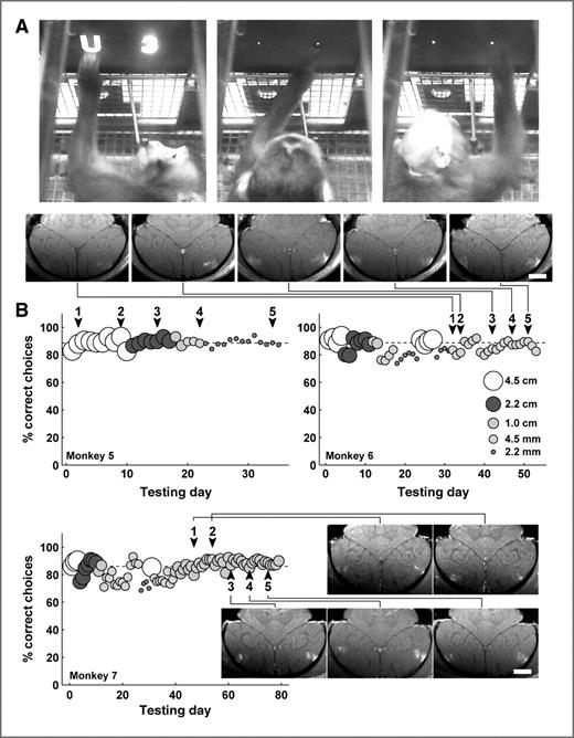 Temporary Disruption of the Blood–Brain Barrier by Use of Ultrasound ...