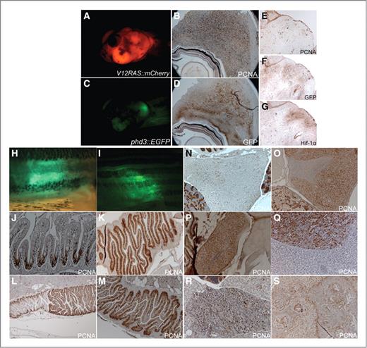 A Zebrafish Model to Study and Therapeutically Manipulate Hypoxia ...