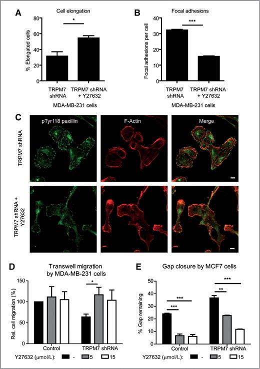 TRPM7 Is Required for Breast Tumor Cell Metastasis | Cancer Research ...