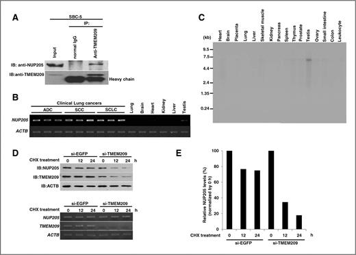 Critical Function for Nuclear Envelope Protein TMEM209 in Human ...