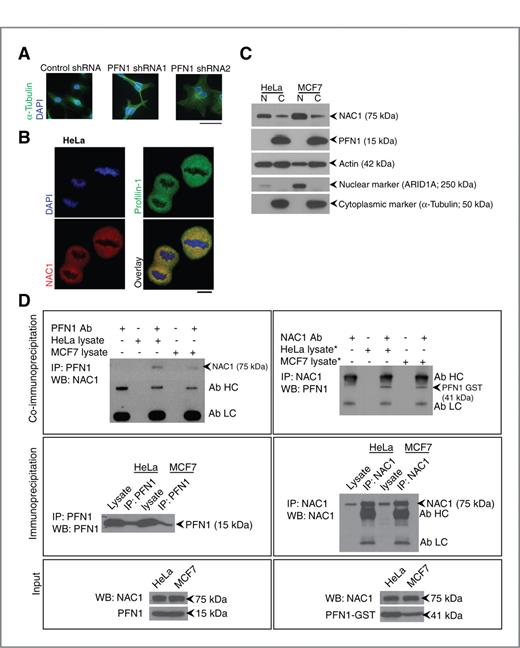 NAC1 Is an Actin-Binding Protein That Is Essential for Effective ...