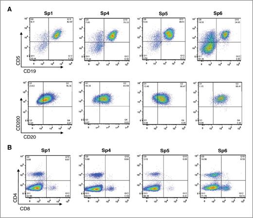 Soluble CD200 Is Critical to Engraft Chronic Lymphocytic Leukemia Cells ...