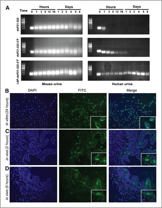 Intravesical Delivery of Small Activating RNA Formulated into Lipid ...