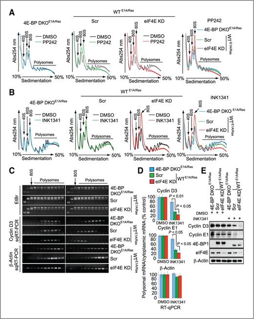 eIF4E/4E-BP Ratio Predicts the Efficacy of mTOR Targeted Therapies ...