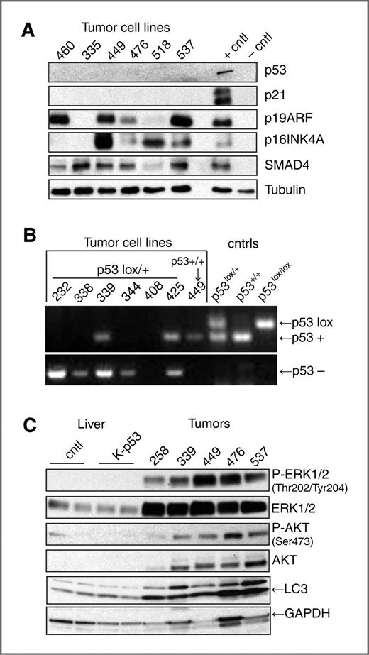 KrasG12D and p53 Mutation Cause Primary Intrahepatic Cholangiocarcinoma ...