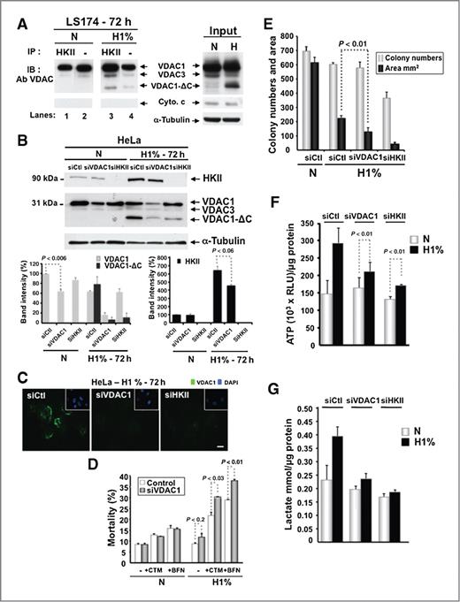 Expression of a Truncated Active Form of VDAC1 in Lung Cancer ...