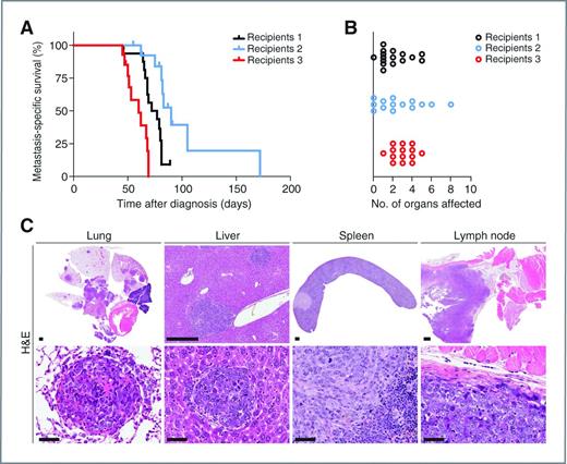 A Preclinical Mouse Model of Invasive Lobular Breast Cancer Metastasis ...