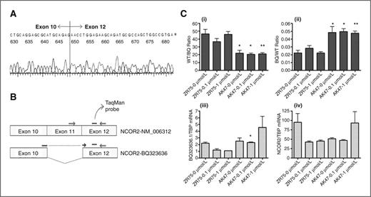SpliceArray Profiling of Breast Cancer Reveals a Novel Variant of NCOR2 ...