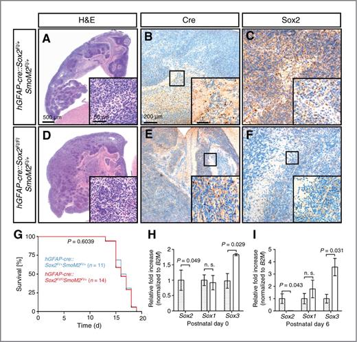 Sox2 Requirement in Sonic Hedgehog-Associated Medulloblastoma | Cancer ...