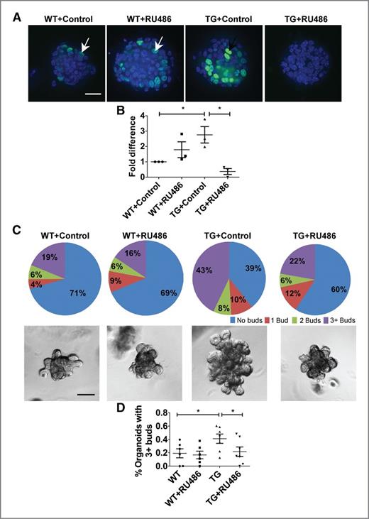 Epimorphin Is a Novel Regulator of the Progesterone Receptor Isoform-A ...