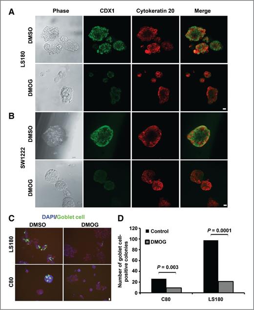 Stem Cell Differentiation and Lumen Formation in Colorectal Cancer Cell ...