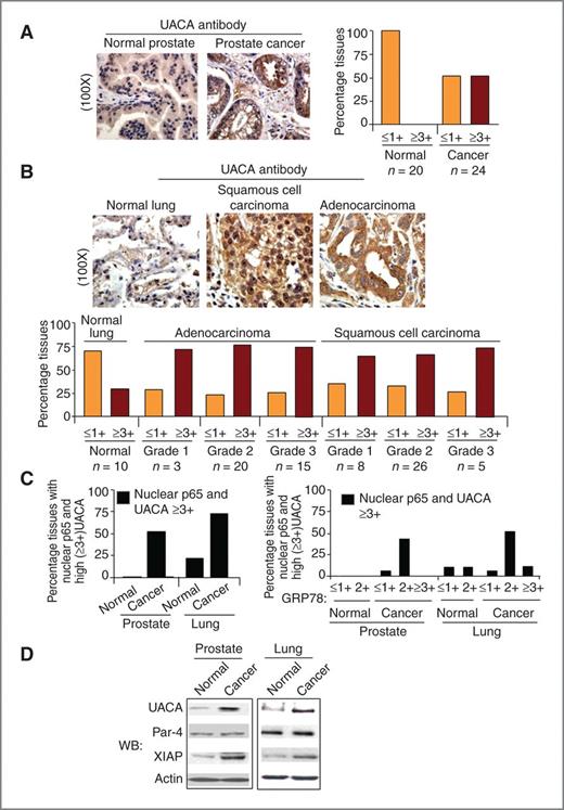 Novel Mechanism of Apoptosis Resistance in Cancer Mediated by ...