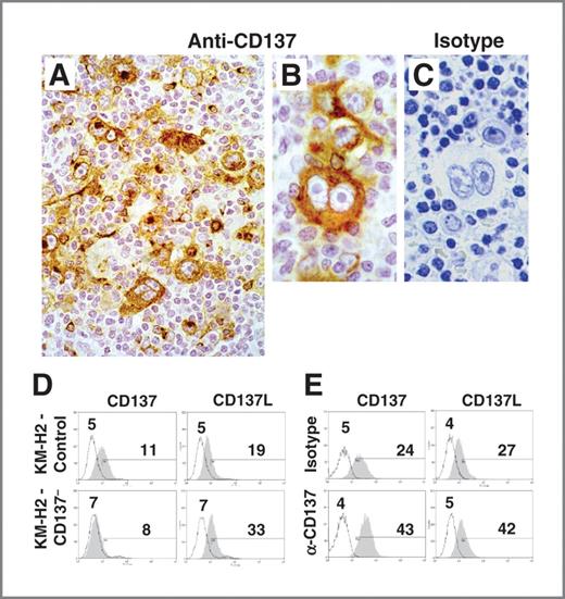 Expression of CD137 on Hodgkin and Reed–Sternberg Cells Inhibits T-cell ...