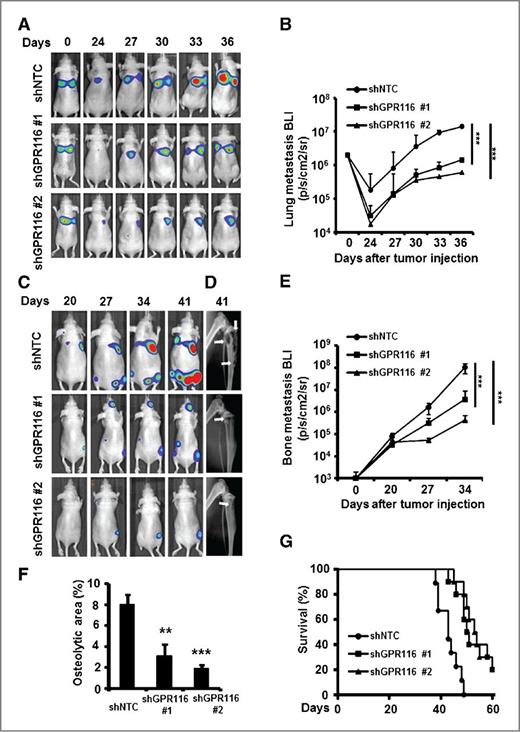 GPR116, an Adhesion G-Protein–Coupled Receptor, Promotes Breast Cancer ...