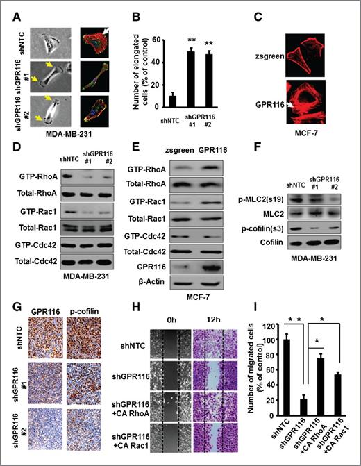 GPR116, an Adhesion G-Protein–Coupled Receptor, Promotes Breast Cancer ...