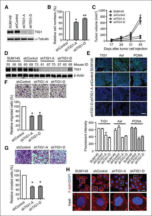 TIG1 Promotes the Development and Progression of Inflammatory Breast ...