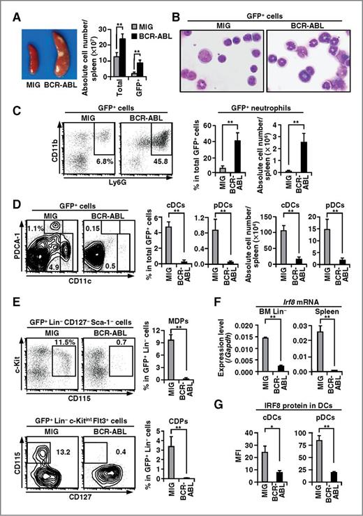 The Transcription Factor IRF8 Counteracts BCR-ABL to Rescue Dendritic ...