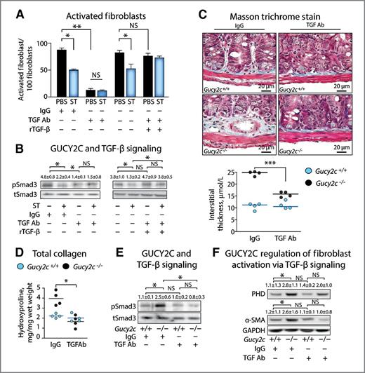 Intestinal GUCY2C Prevents TGF-β Secretion Coordinating Desmoplasia and ...