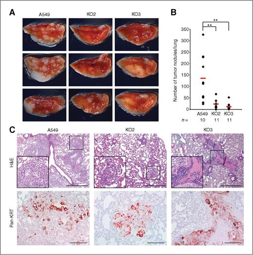 The Noncoding RNA MALAT1 Is a Critical Regulator of the Metastasis ...
