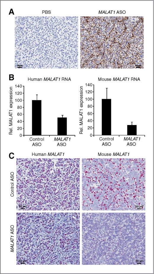 The Noncoding RNA MALAT1 Is a Critical Regulator of the Metastasis ...