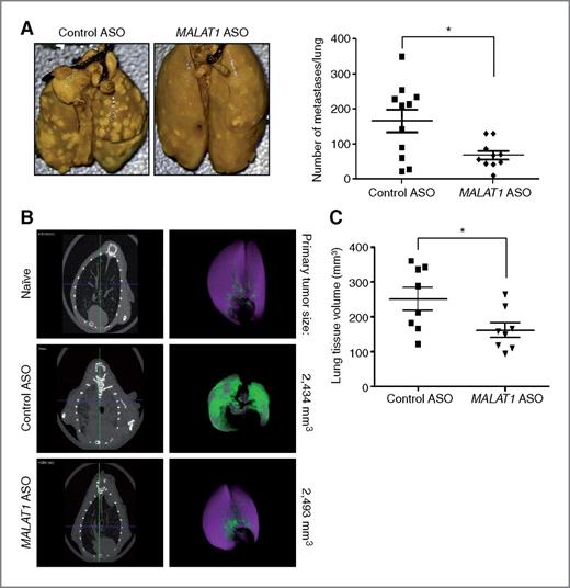 The Noncoding RNA MALAT1 Is a Critical Regulator of the Metastasis ...