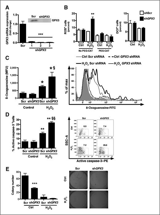 Tumor Suppressor Function of the Plasma Glutathione Peroxidase Gpx3 in ...