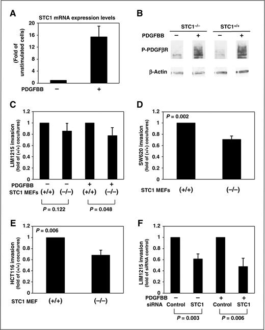 STC1 Expression By Cancer-Associated Fibroblasts Drives Metastasis of ...