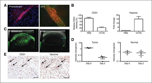 Oncolytic Vaccinia Virus Disrupts Tumor-Associated Vasculature in ...