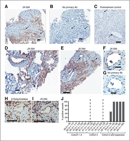 Oncolytic Vaccinia Virus Disrupts Tumor-Associated Vasculature in ...