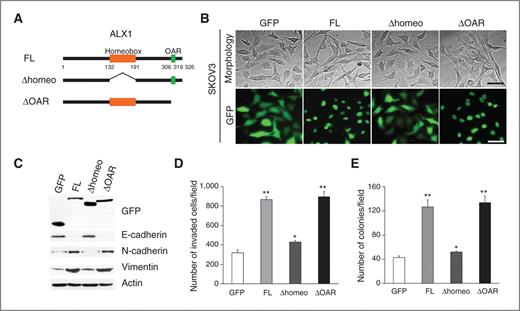 ALX1 Induces Snail Expression to Promote Epithelial-to-Mesenchymal ...
