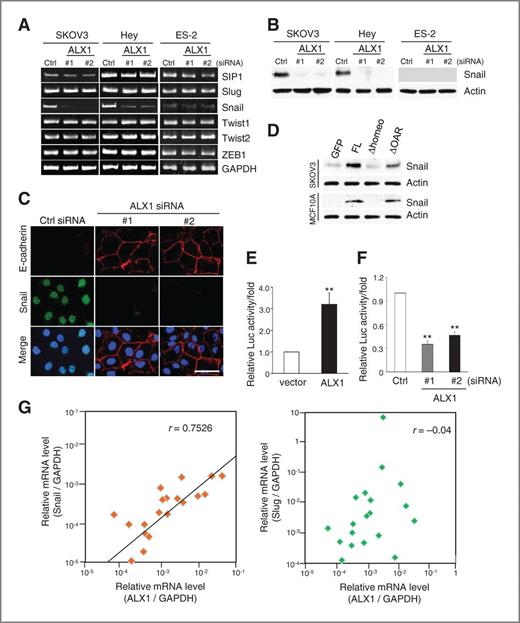 ALX1 Induces Snail Expression to Promote Epithelial-to-Mesenchymal ...