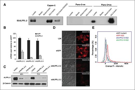 Alkaline Phosphatase ALPPL-2 Is a Novel Pancreatic Carcinoma-Associated ...