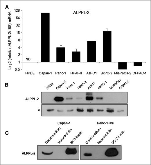 Alkaline Phosphatase ALPPL-2 Is a Novel Pancreatic Carcinoma-Associated ...