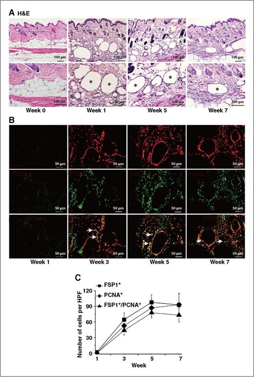 Fibroblast-Specific Protein 1/S100A4–Positive Cells Prevent Carcinoma ...