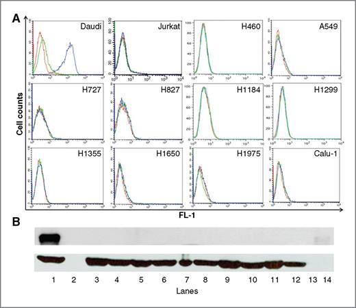 A Reevaluation of CD22 Expression in Human Lung Cancer | Cancer ...