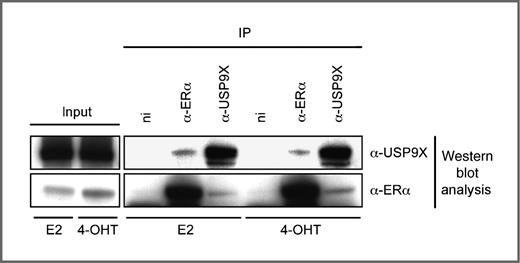 USP9X Downregulation Renders Breast Cancer Cells Resistant to Tamoxifen ...